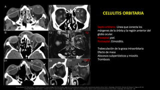 URGENCIAS NO TRAUMATICAS DE CABEZA Y CUELLO.pptx