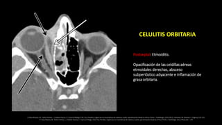 URGENCIAS NO TRAUMATICAS DE CABEZA Y CUELLO.pptx