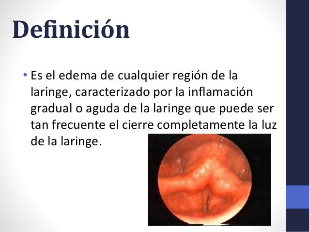 Urgencias urgencias respiratorias