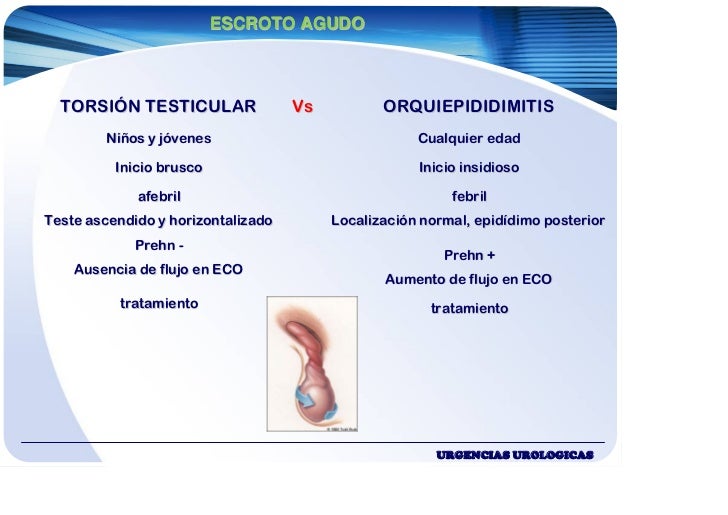 Urgencias urologicas
