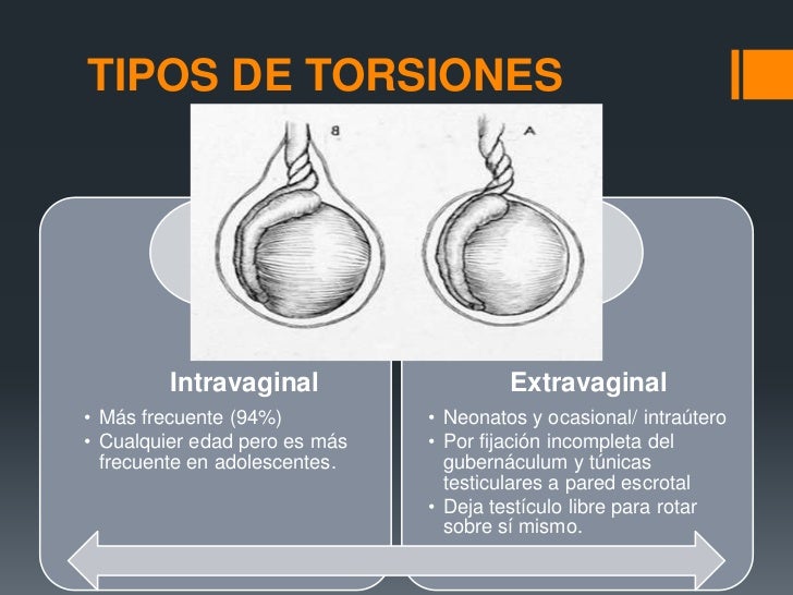 Urgencias urologicas