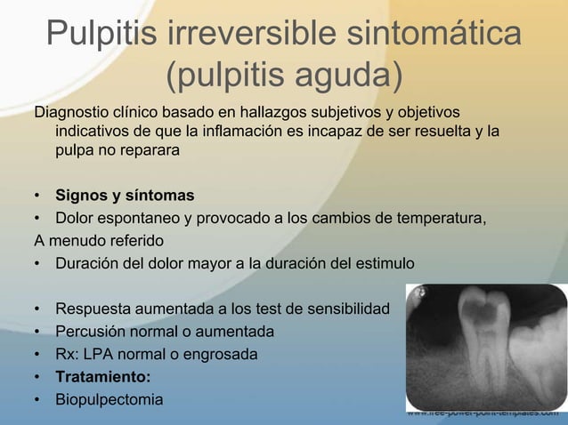 Urgencias y emergencias en odontología pulpitis | PPTX