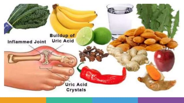 Uric-Acid-and-Food.pptx