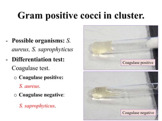 microbiology urinary system laboratory medical students undegrauates | PPTX