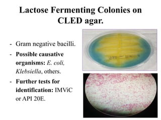 microbiology urinary system laboratory medical students undegrauates | PPTX
