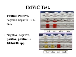 microbiology urinary system laboratory medical students undegrauates | PPTX