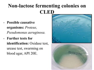 microbiology urinary system laboratory medical students undegrauates | PPTX