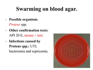 microbiology urinary system laboratory medical students undegrauates | PPTX
