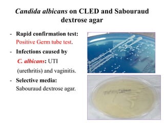 microbiology urinary system laboratory medical students undegrauates | PPTX