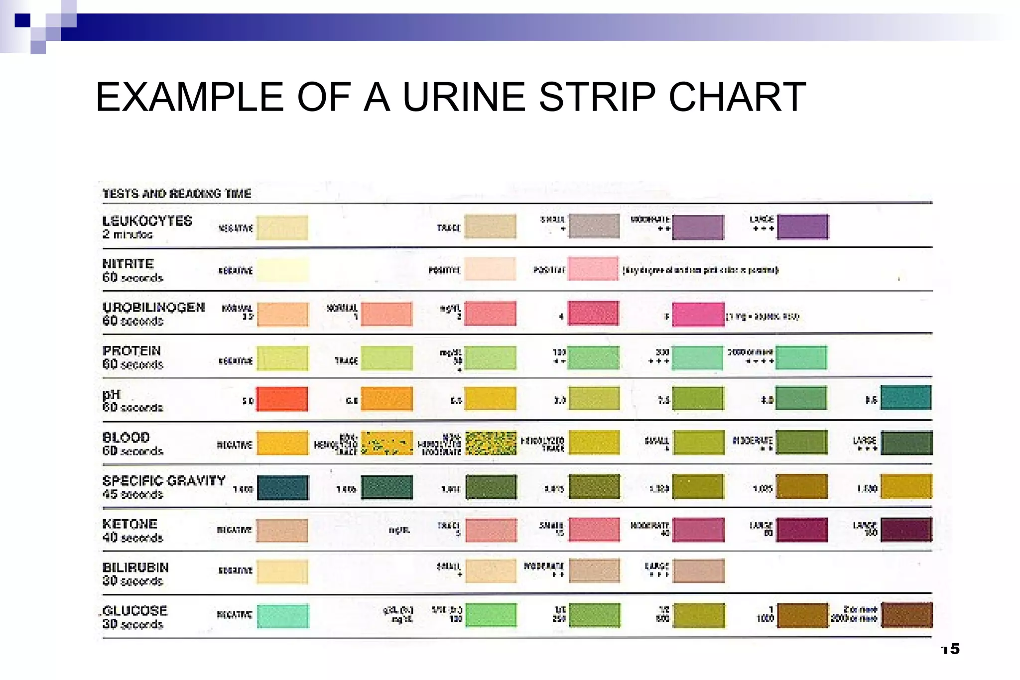 Urinalysis | PPT