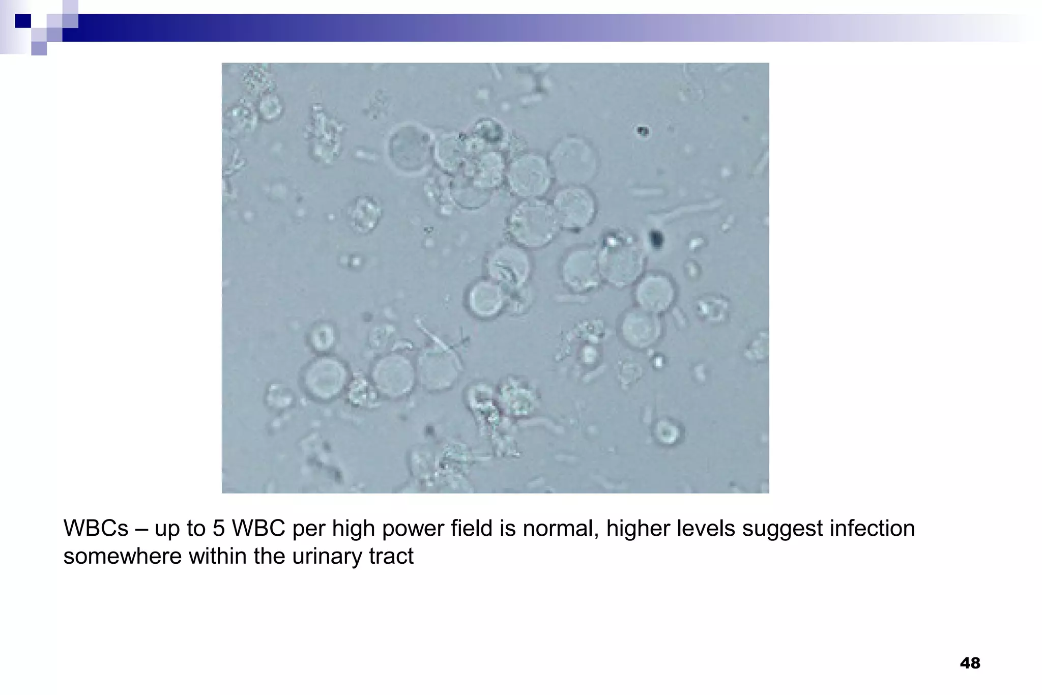 Urinalysis | PPT