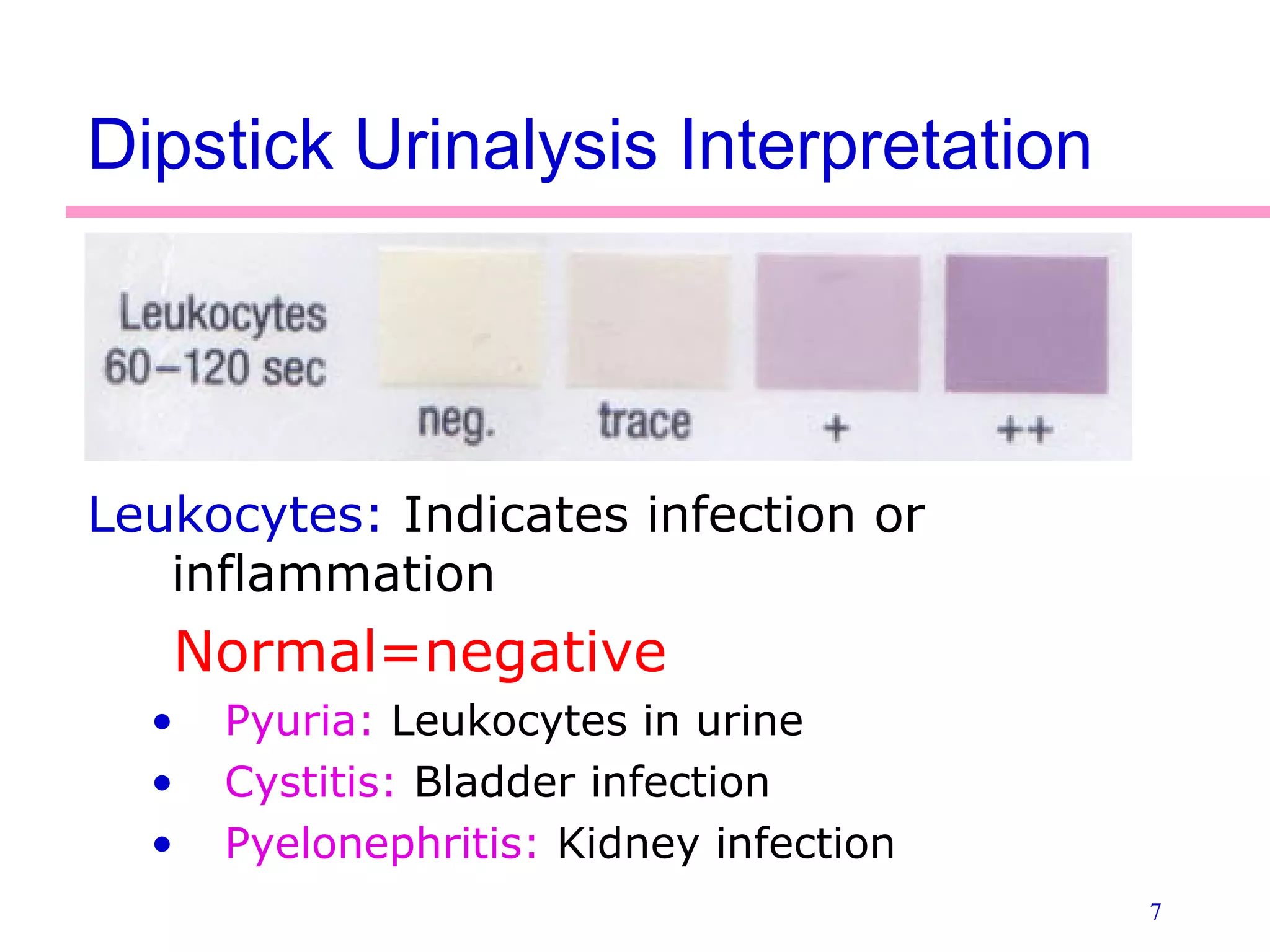 Urinalysis | PPT