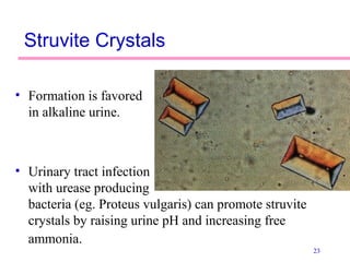 Urinalysis | PPT