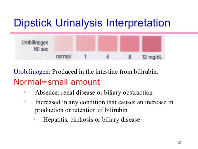 Urinalysis