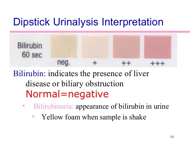 Large Blood In Urine Dip: Blood In Urine Dipstick Test – QEQRW