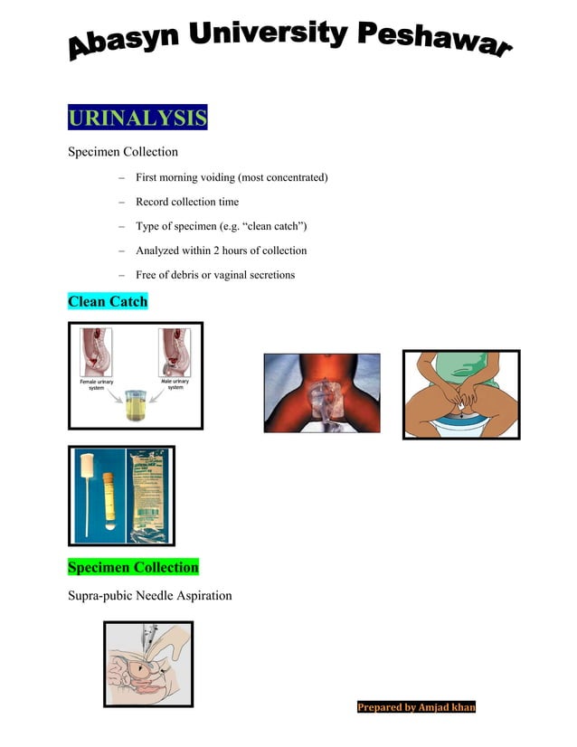 Urinalysis