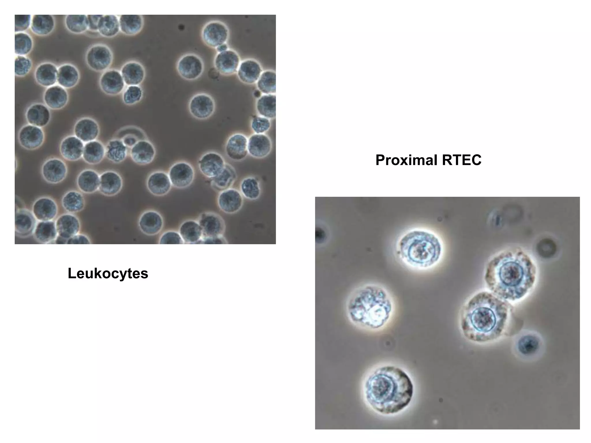 Urinalysis | PPTX