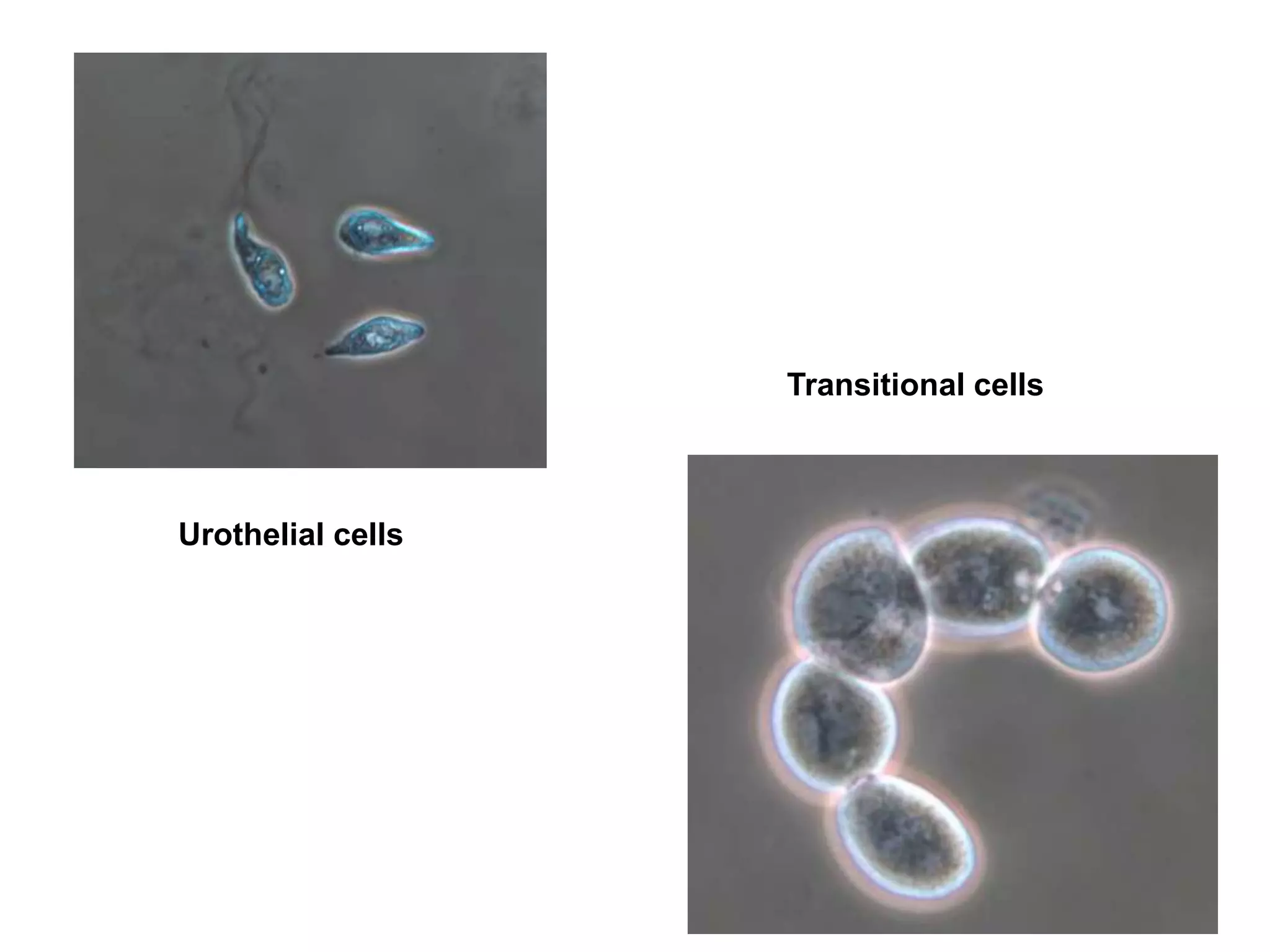 Urinalysis | PPTX
