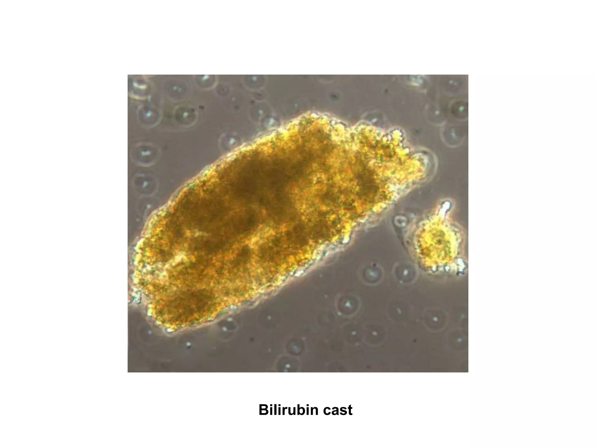 Urinalysis | PPTX