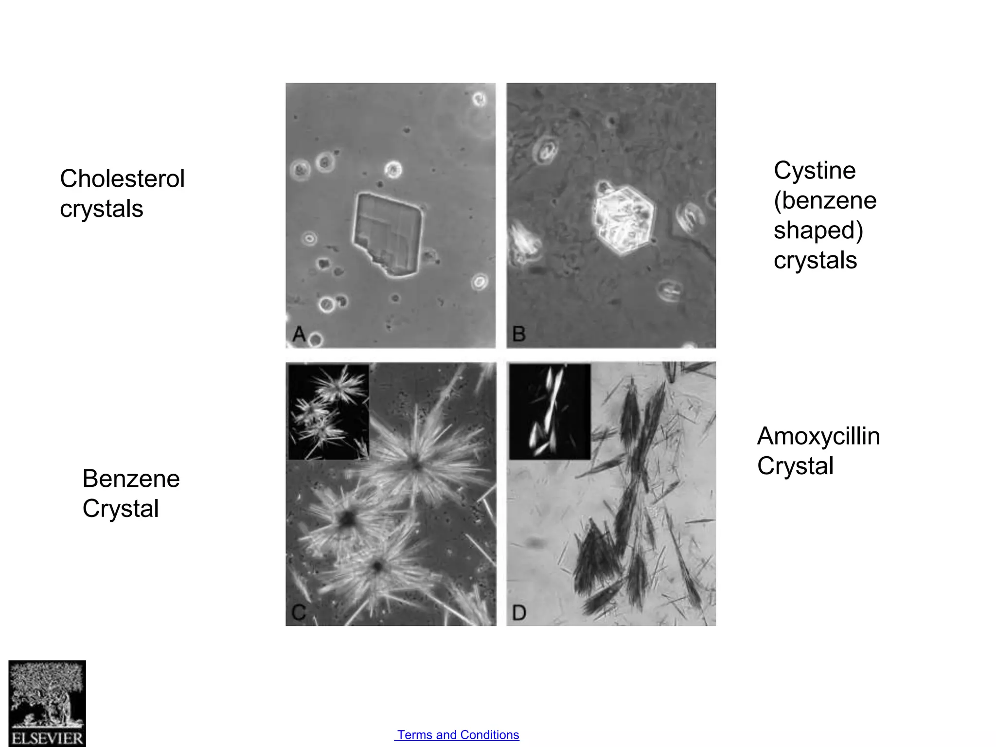 Urinalysis | PPTX