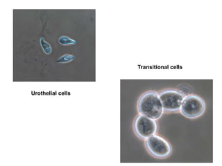 Urinalysis | PPTX