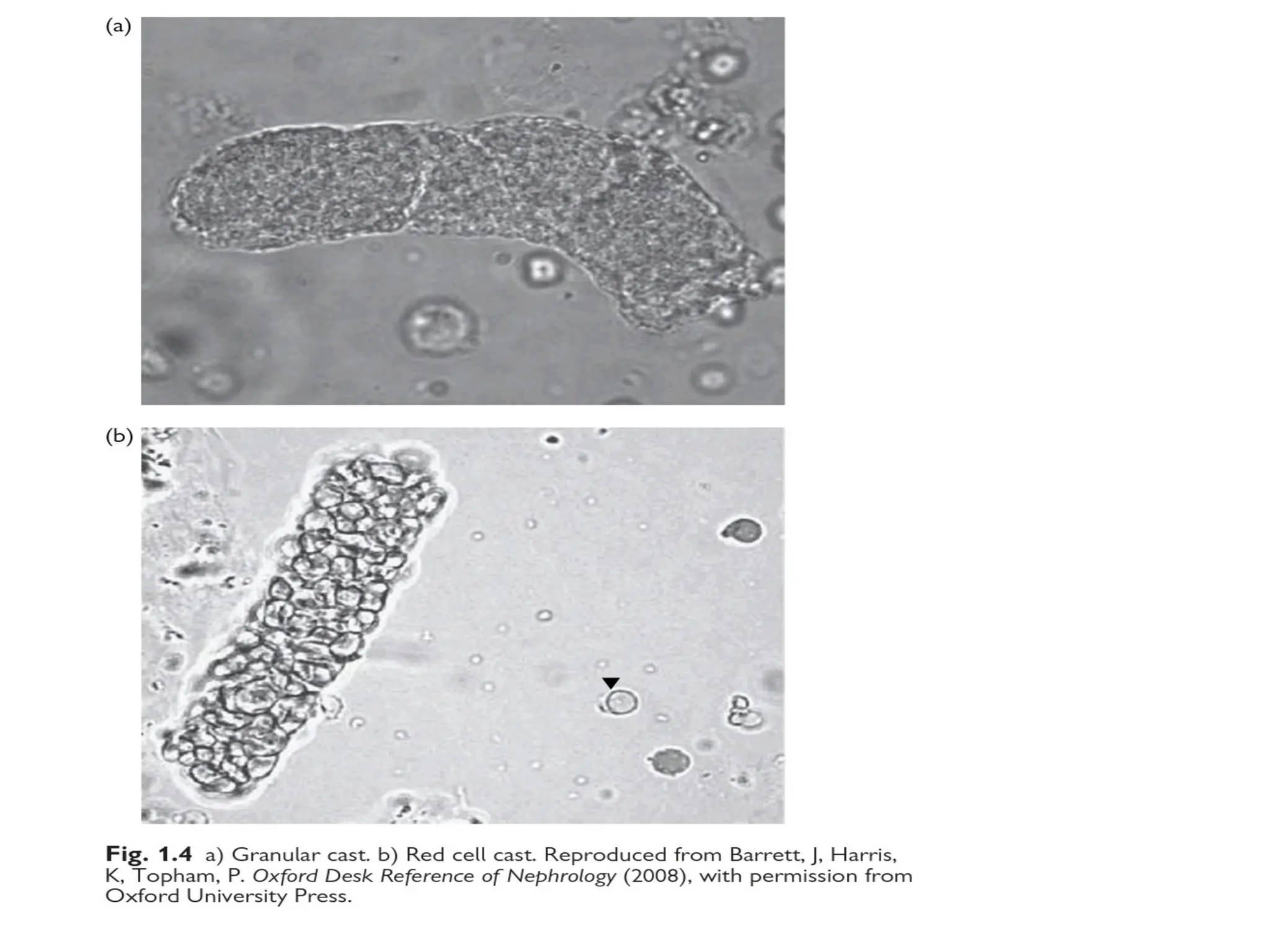 Slide on Urine analysis and urine microscopy | PPT