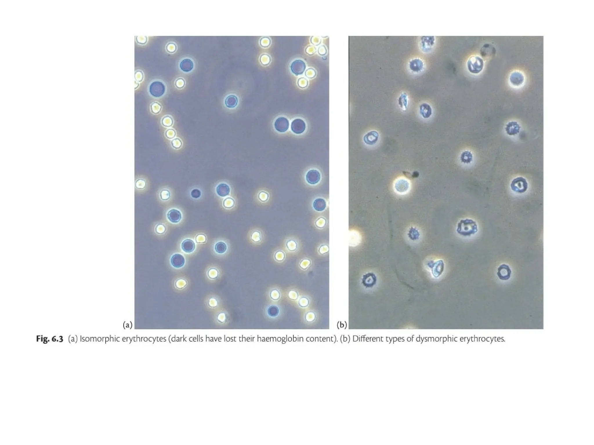 Slide on Urine analysis and urine microscopy | PPT