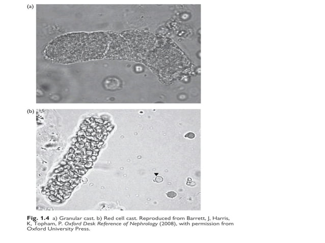 Slide on Urine analysis and urine microscopy | PPT