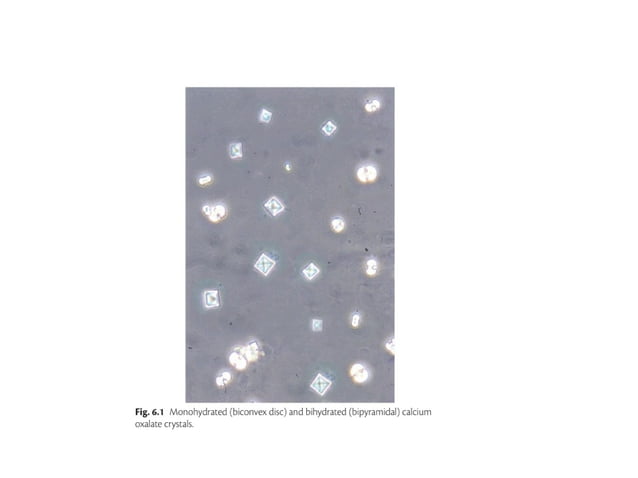 Slide on Urine analysis and urine microscopy | PPT