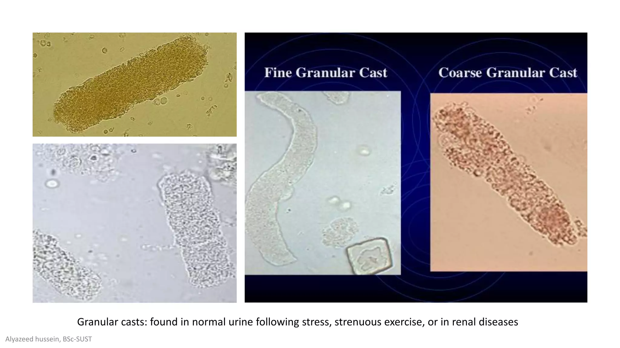 Urinalysis a comprehensive review | PPTX
