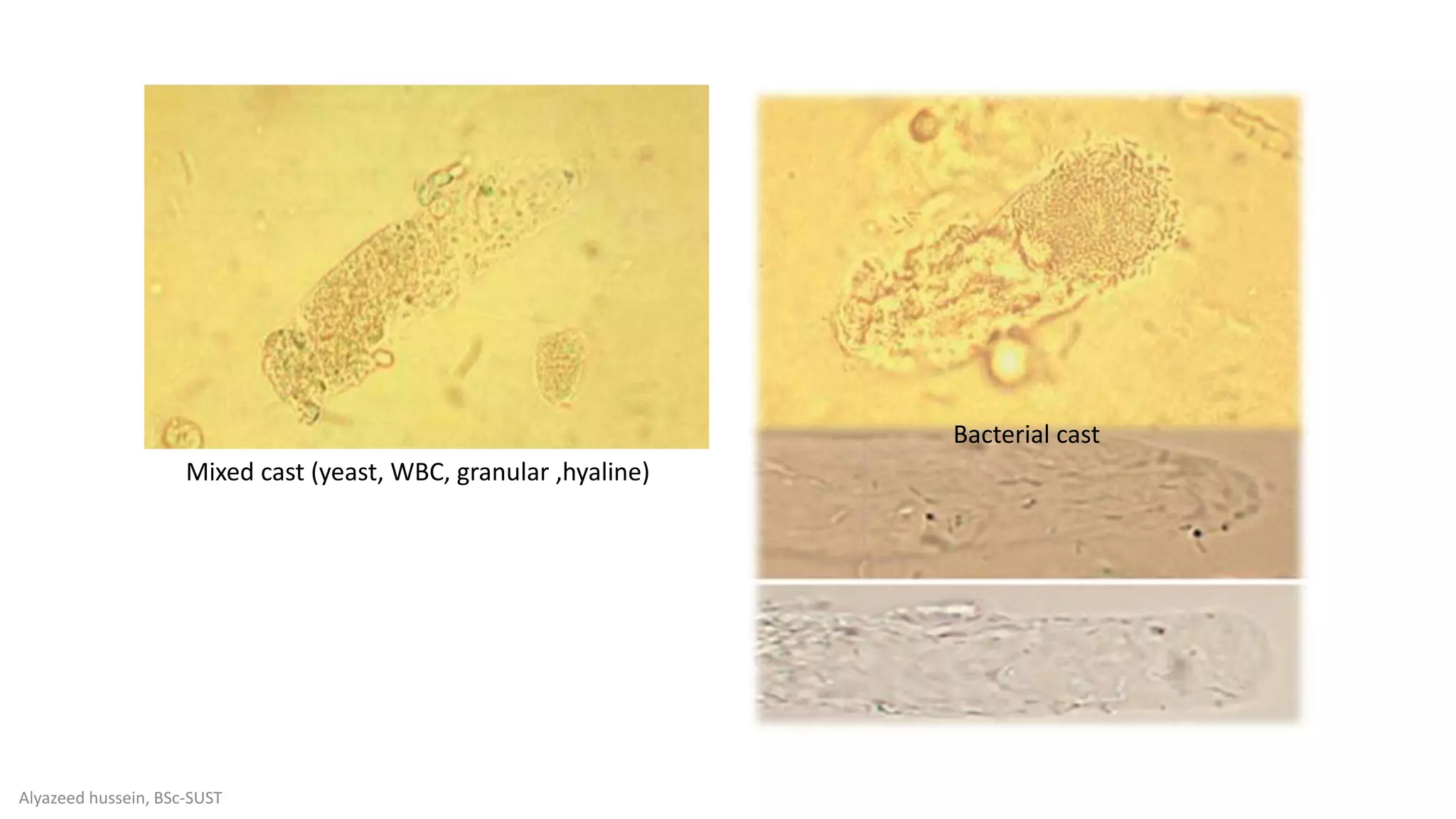 Urinalysis a comprehensive review | PPTX