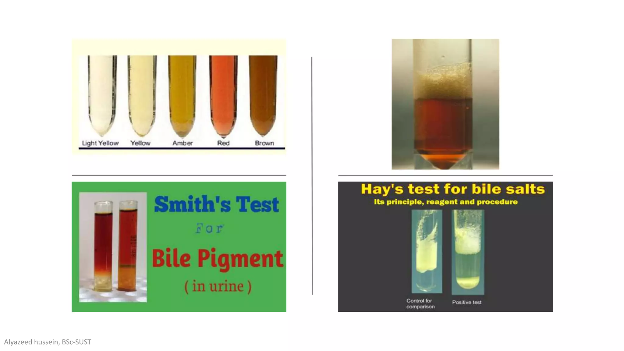 Urinalysis a comprehensive review | PPTX