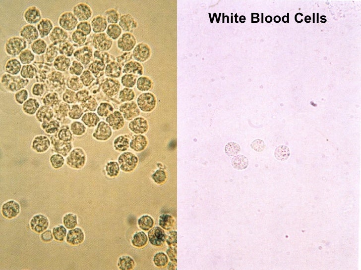 Urinalysis urinalysis