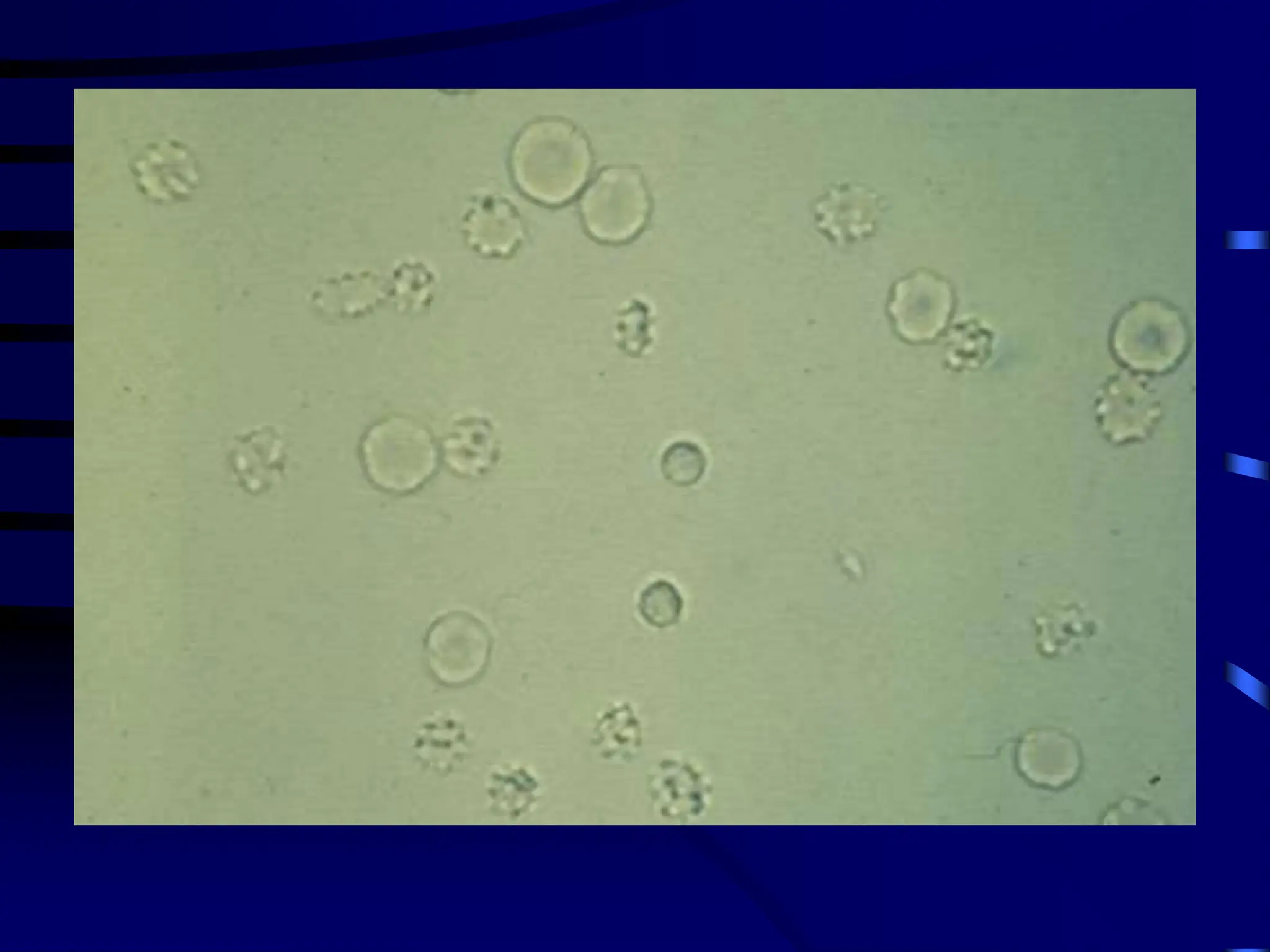 Urinalysis; urine examination in the lab.ppt