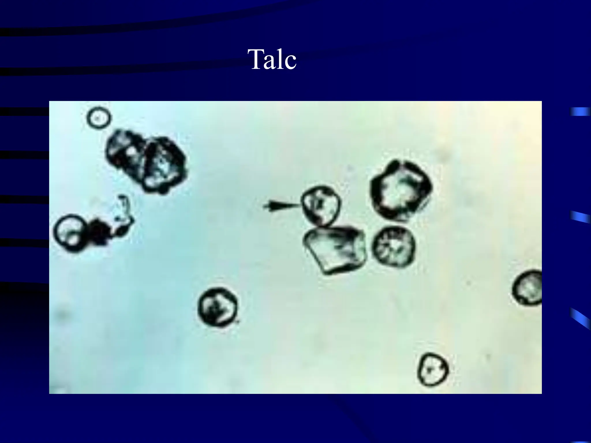 Urinalysis; urine examination in the lab.ppt