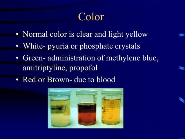 Urinalysis; urine examination in the lab.ppt | Blood Disorders ...