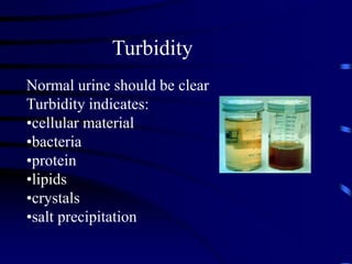 Urinalysis; urine examination in the lab.ppt