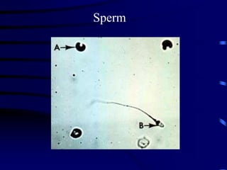 Urinalysis; urine examination in the lab.ppt