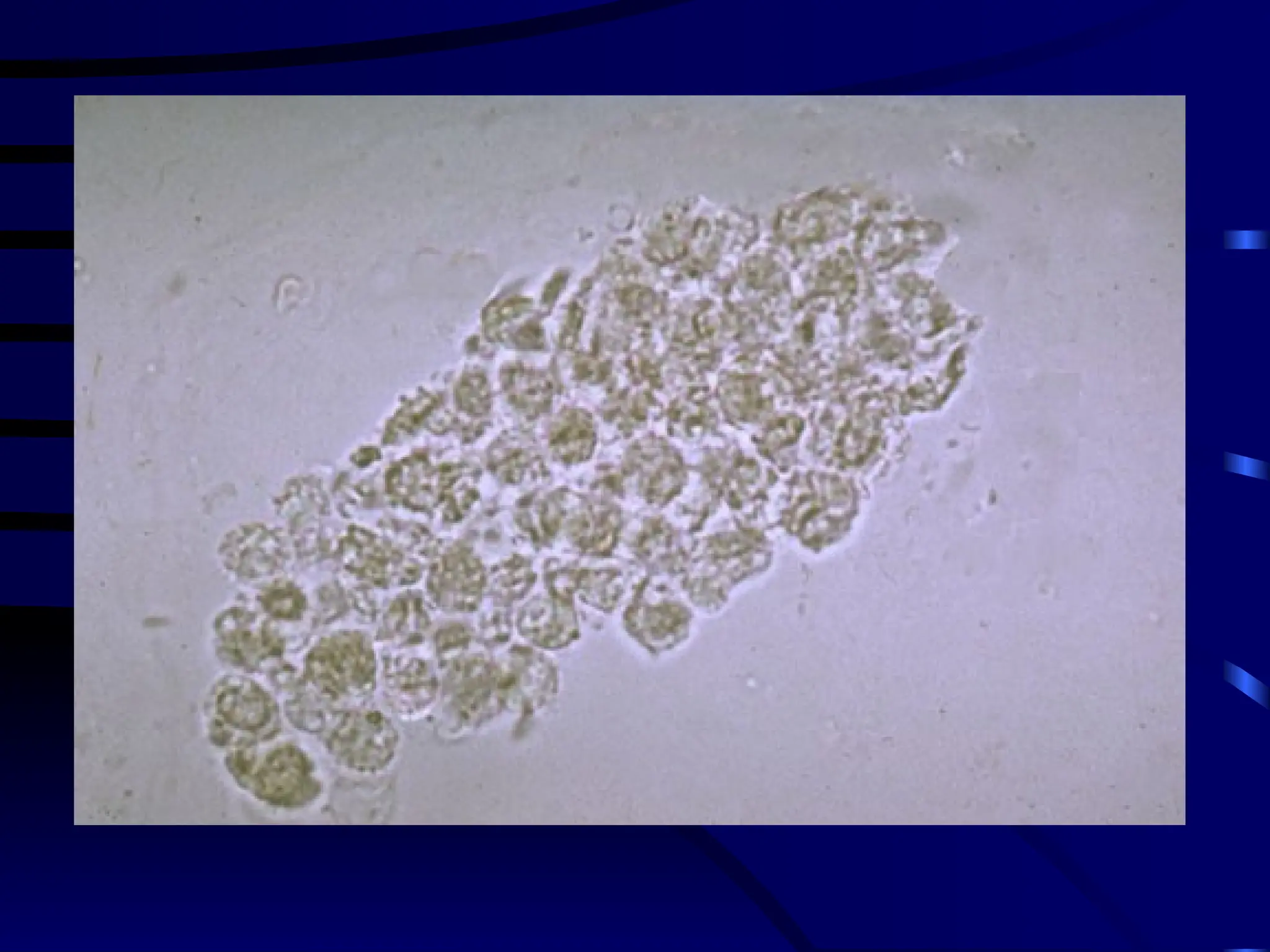 Complete Urinalysis microscopy and macroscopy | PPT