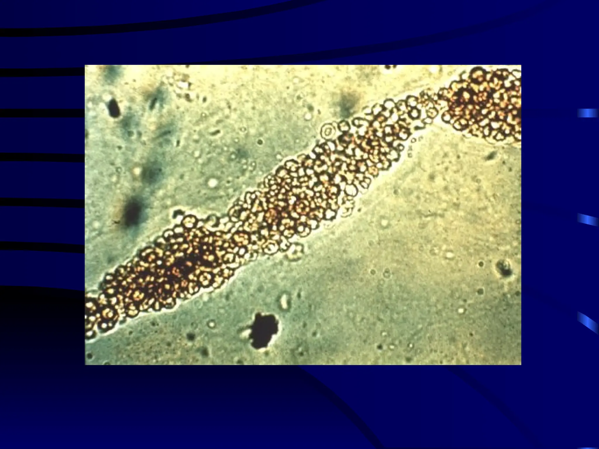Complete Urinalysis microscopy and macroscopy | PPT