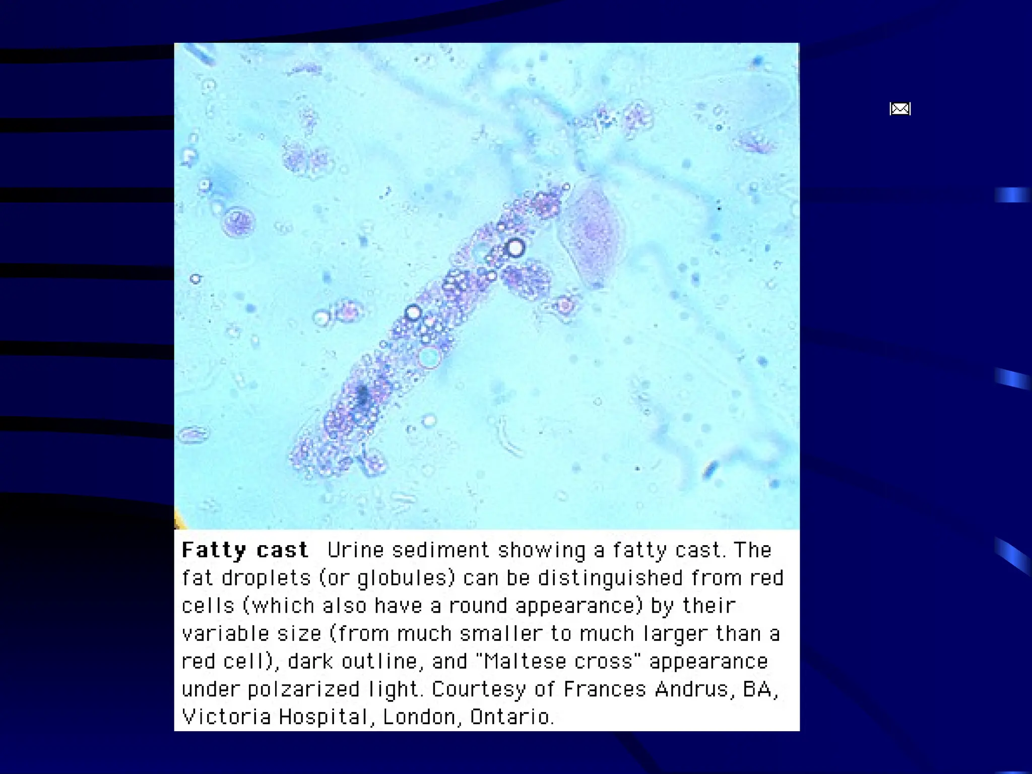 Complete Urinalysis microscopy and macroscopy | PPT