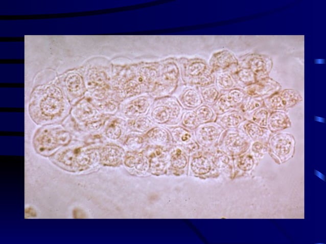 Complete Urinalysis microscopy and macroscopy | PPT