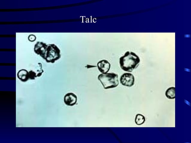 Complete Urinalysis microscopy and macroscopy | PPT