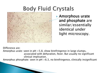 Urinalysis and body fluid crystals | PPT