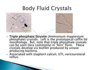 Magnesium Phosphate Crystals