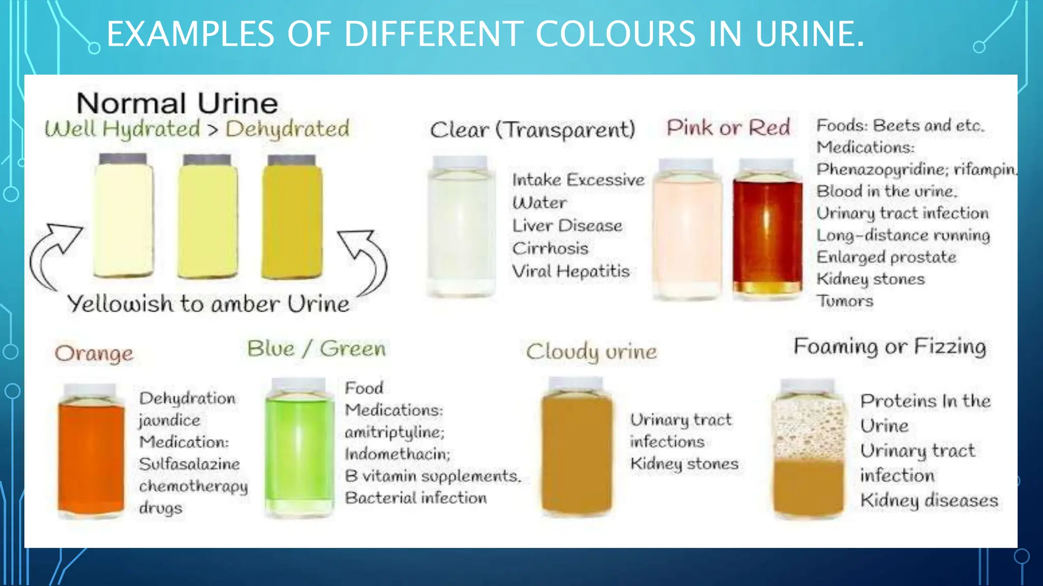 urinalysis and urine culture presentation1).pptx
