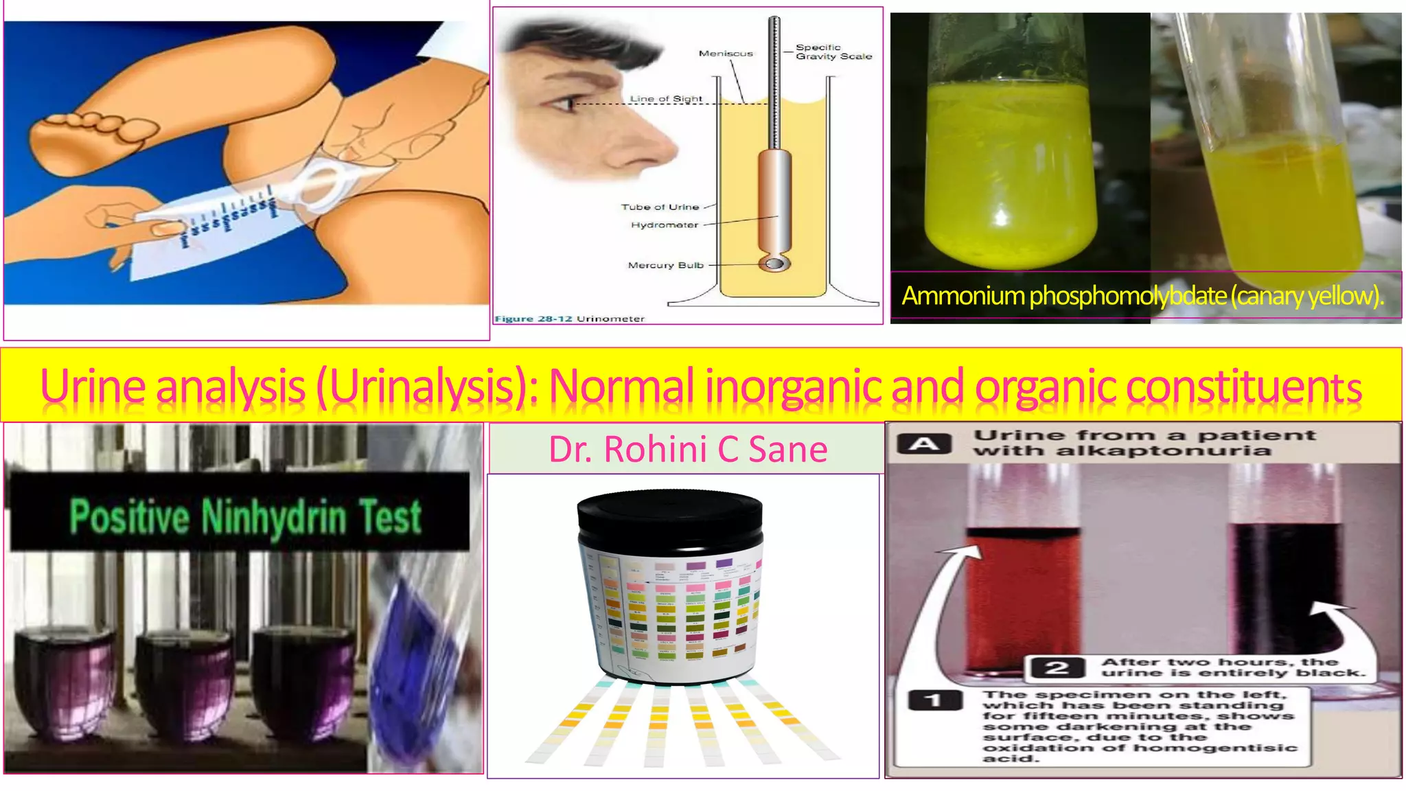 Urinalysis for detection of normal inorganic and organic constituents | PDF