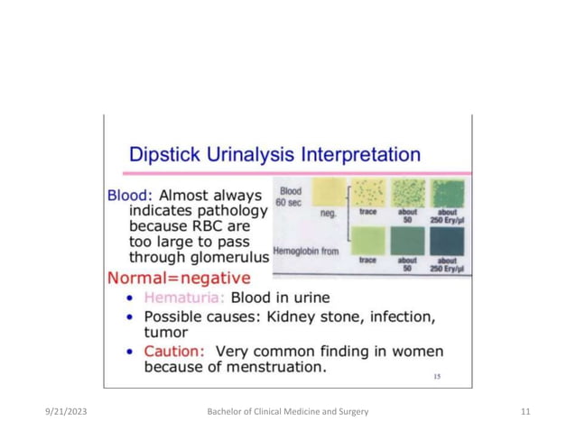 Urinalysis interpretation.pptx