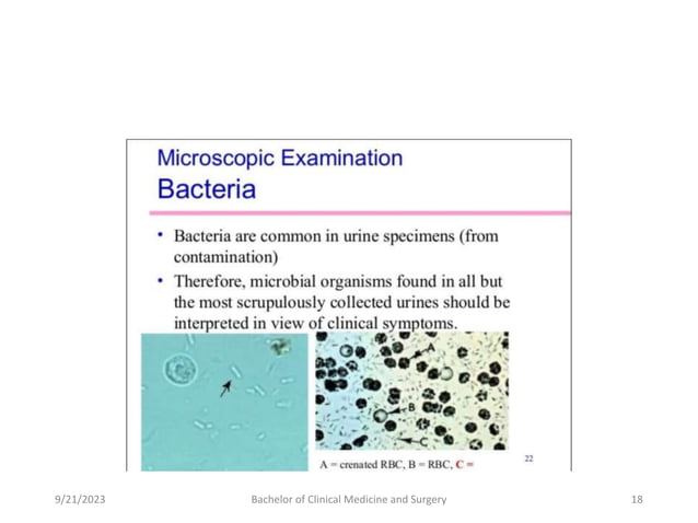 Urinalysis interpretation.pptx