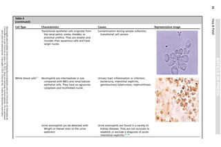 Urinalysis Interpretation and Clinical Correlations.pdf